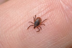 Ticks in Spanish | English to Spanish Translation - SpanishDictionary.com