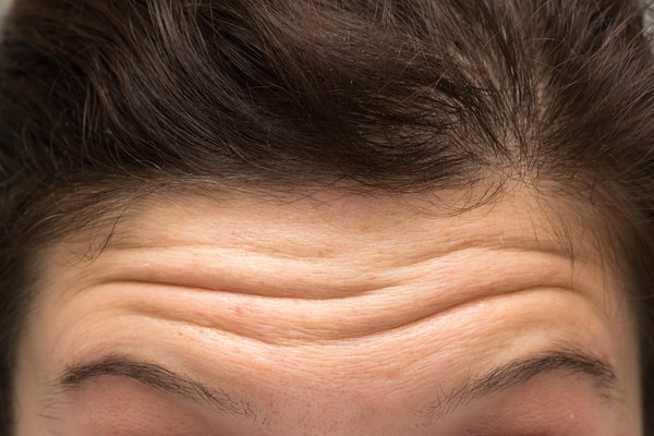 Forehead in Spanish | English to Spanish Translation ...